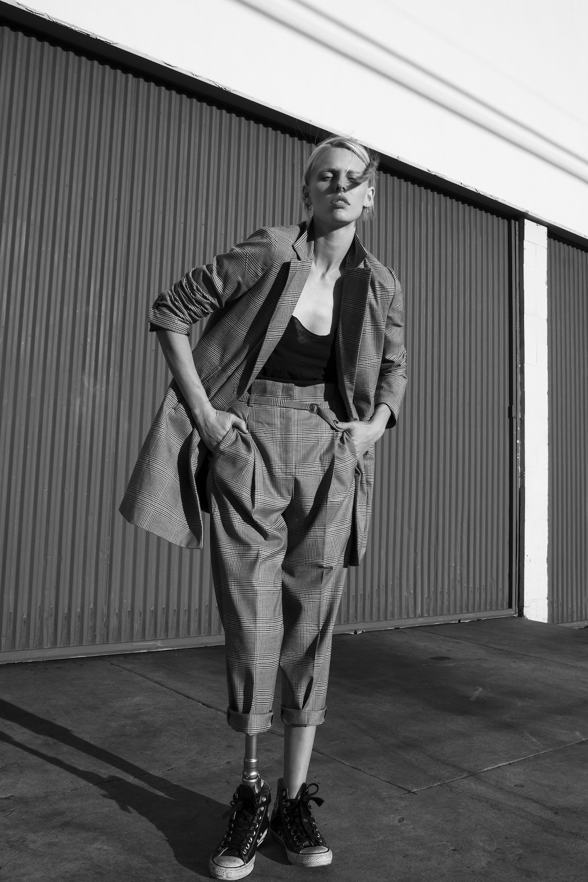 'I Survived TSS,' Model Lauren Wasser Shares Her Story - Darling Magazine